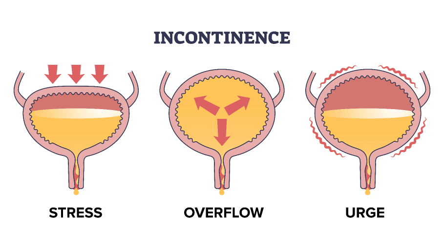 Incontinence Integrative Urology